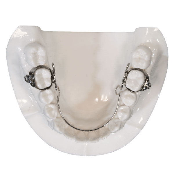 Wilson 3D Lingual Arch – Five Star Ortho